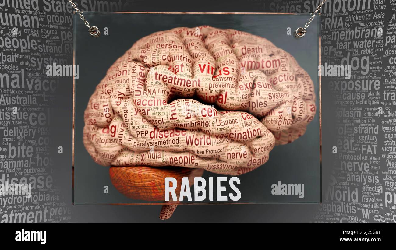 Anatomie de la rage - ses causes et effets projetés sur un cerveau ...