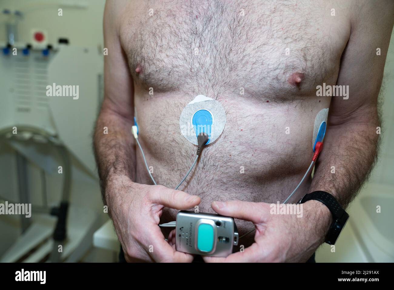 Trouble du rythme cardiaque Banque de photographies et d’images à haute ...