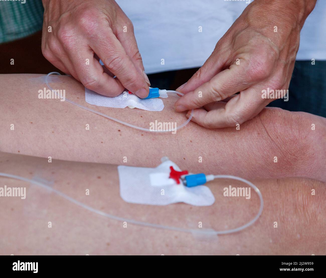 Une injection sous-cutanée est administrée en bolus dans la subcutis[1 ...