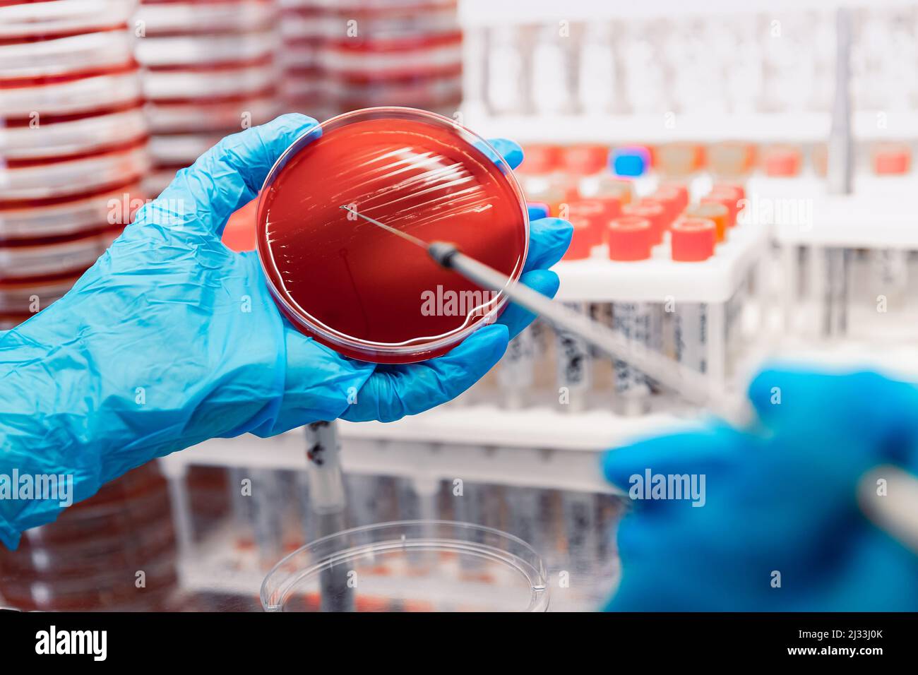 Concept de microbiologie, main de l'agent médical sur les bactéries de culture sur plaque de ...