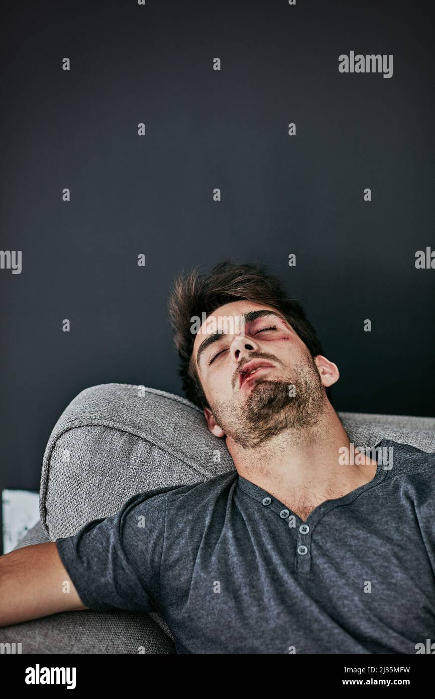 Battus et brisés. Plan court d'un jeune homme battu et meurtri qui ...