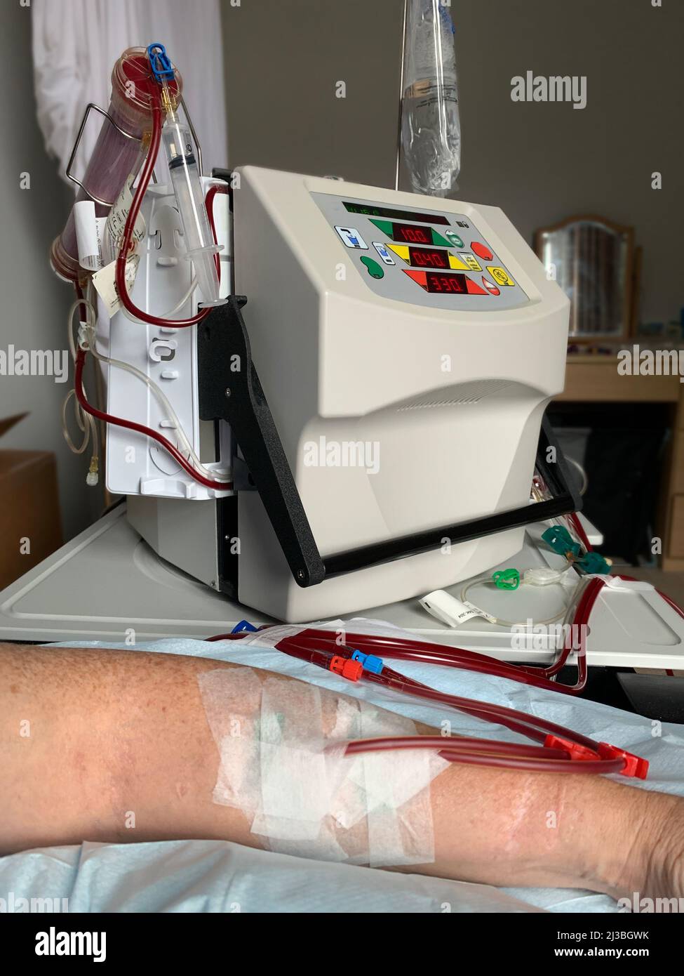 Dialysis machine Banque de photographies et d’images à haute résolution ...