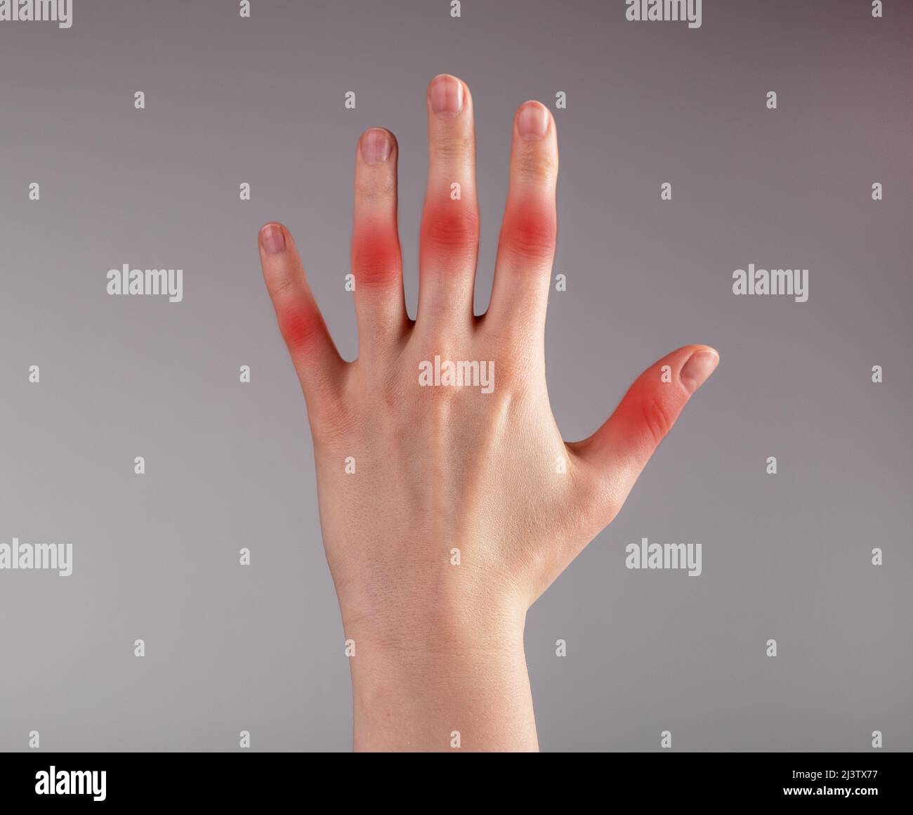 Douleurs un doigt Banque de photographies et d’images à haute ...