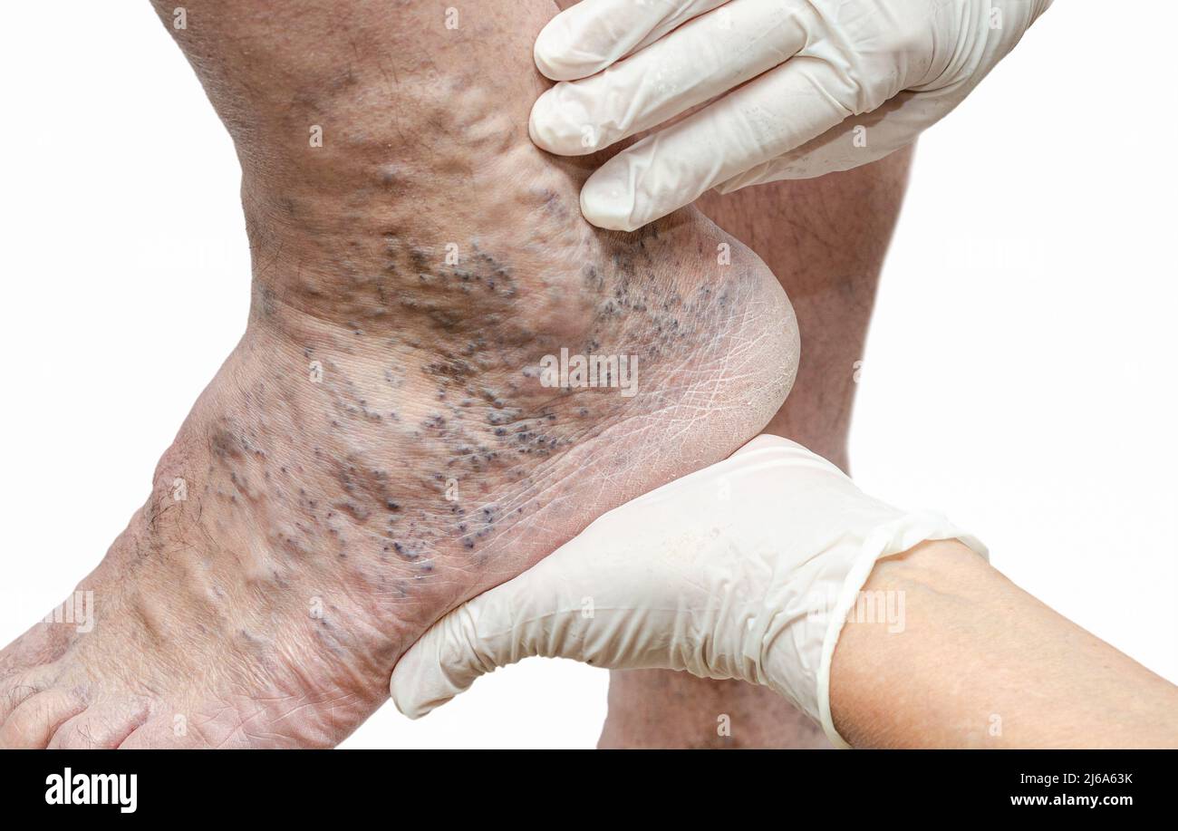 Médecin en gants blancs tenant le pied de l'homme et pointant vers les ...