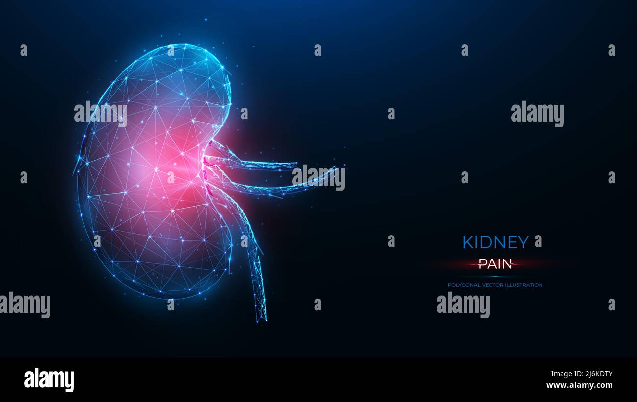 Illustration vectorielle polygonale d'un rein humain enflammé sur fond ...