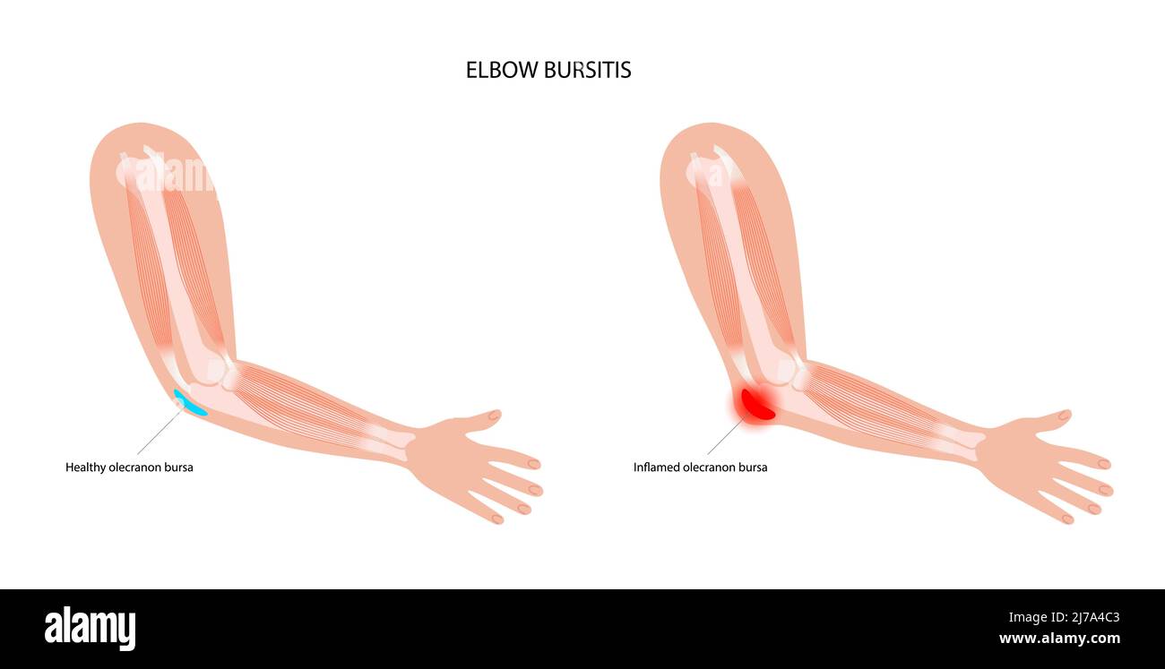 Coude olécranon Banque d'images détourées - Alamy