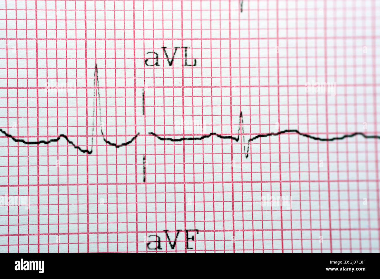 ECG d'électrocardiogramme dans un papier graphique montre le rythme ...