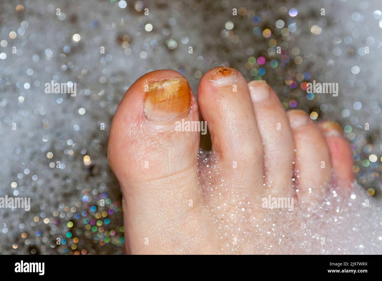 Digitus pedis Banque de photographies et d’images à haute résolution ...