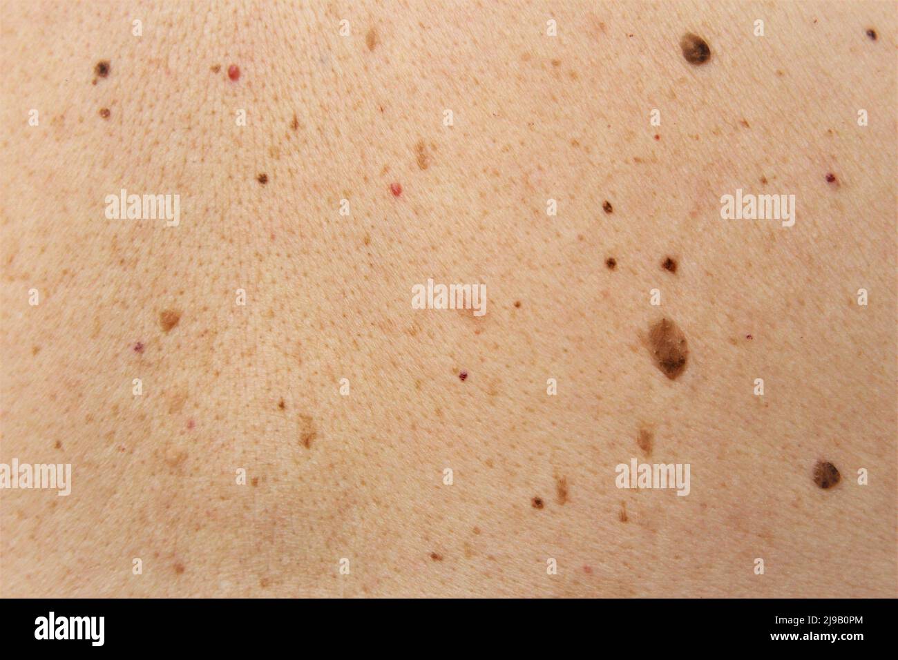 Skin scarification Banque de photographies et d’images à haute ...