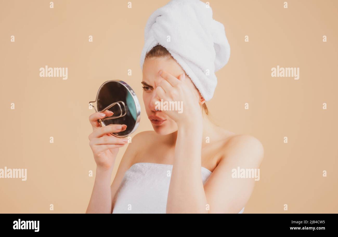 Taches de défaut d'acné sur la peau de la femme. Peau de beauté jeune ...