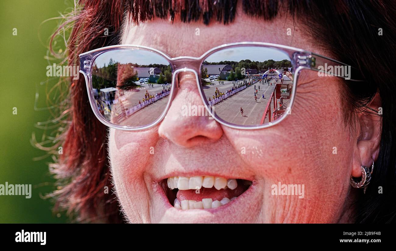 Cancer du nez Banque de photographies et d’images à haute résolution ...