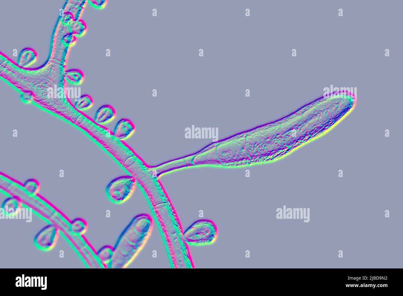 Champignons de Trichophyton rubrum, œuvres d'art Photo Stock - Alamy