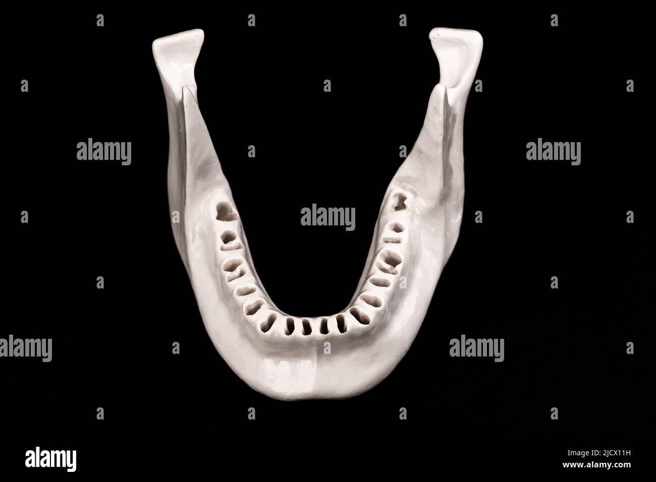 La mâchoire supérieure humaine sans dents modèle d'implant médical ...