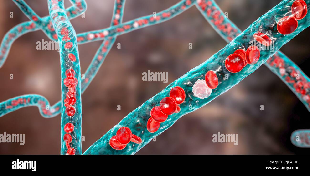 Sistema circulatorio arterial Banque de photographies et d’images à ...