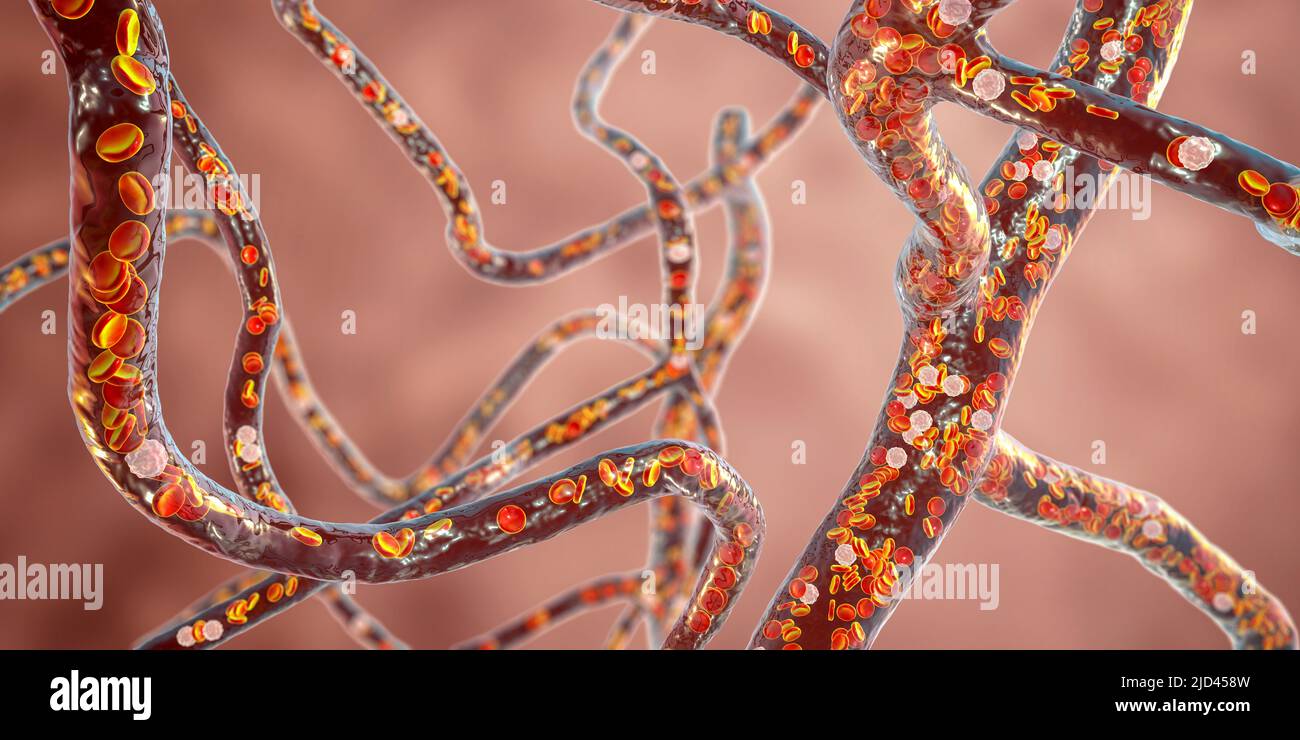 Sistema circulatorio arterial Banque de photographies et d’images à ...