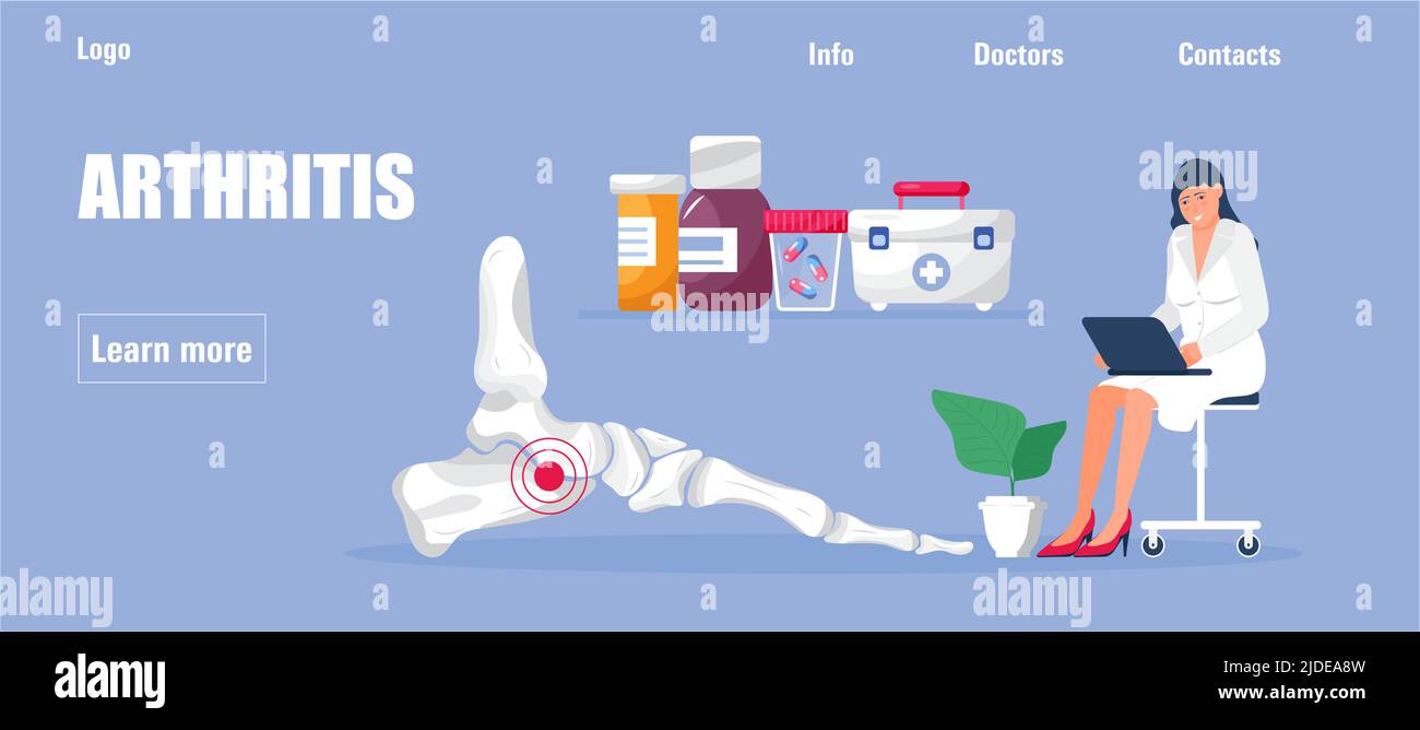 Polyarthrite rhumatoïde du pied. Les médecins minuscules traitent le ...