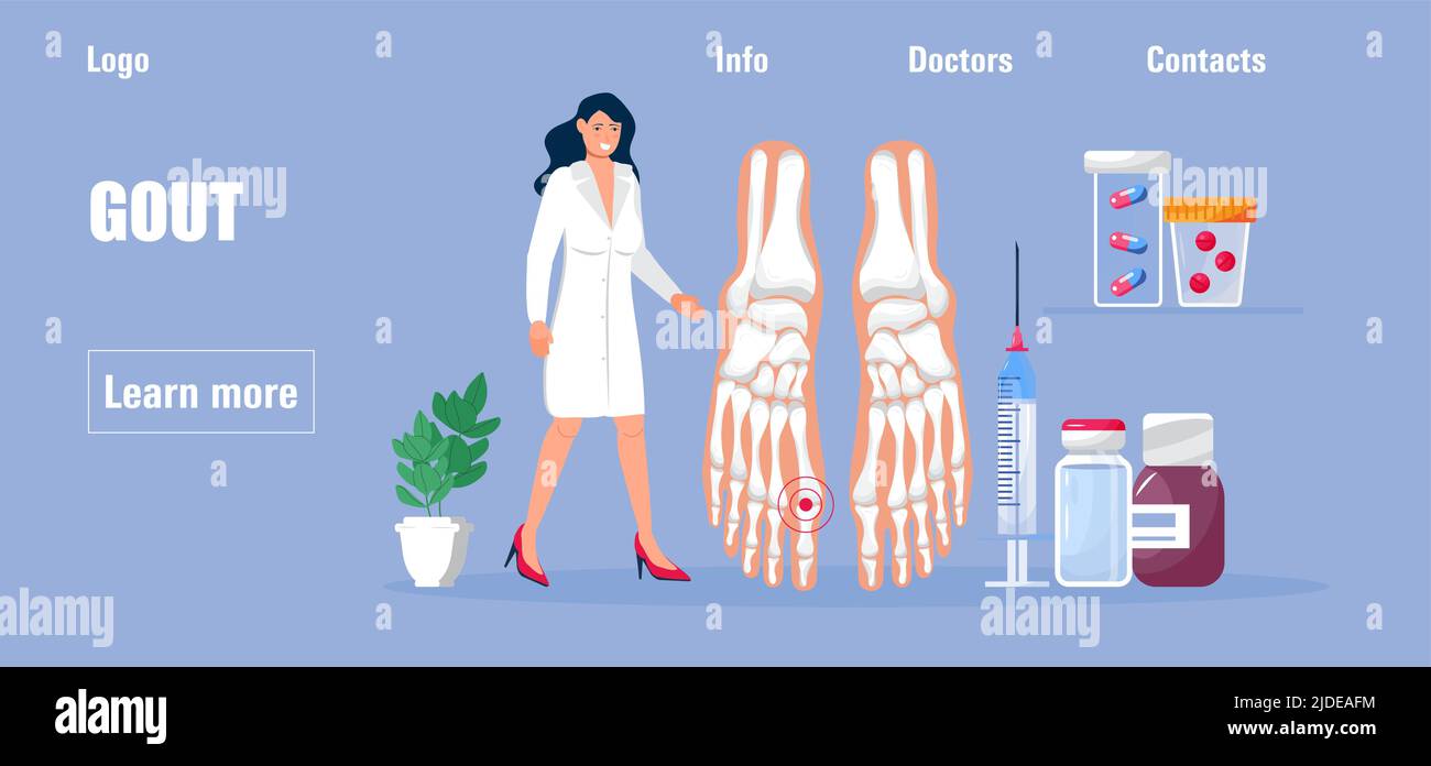 Polyarthrite rhumatoïde du pied. Les médecins minuscules traitent le ...