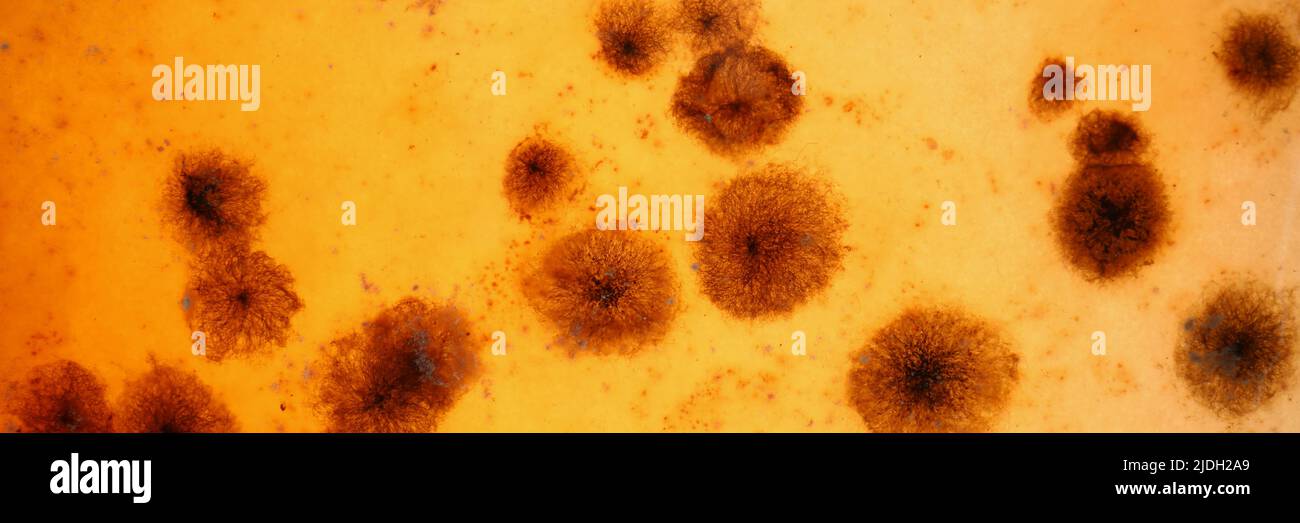 Microbes pathogènes Banque de photographies et d’images à haute ...