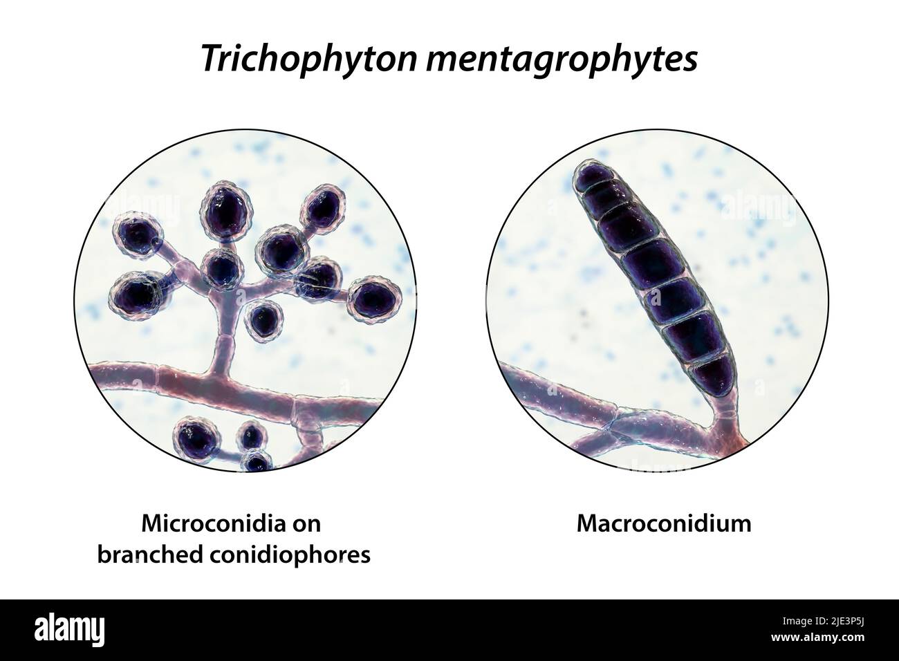 Champignons Trichophyton mentagrophytes, la cause du pied de l'athlète ...