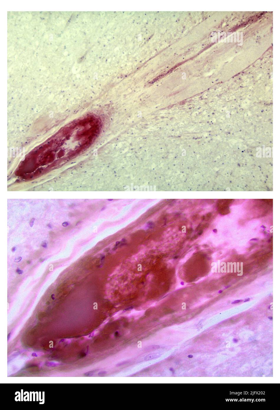Un photomicrographe de la moelle épinière lombaire représentant un ...