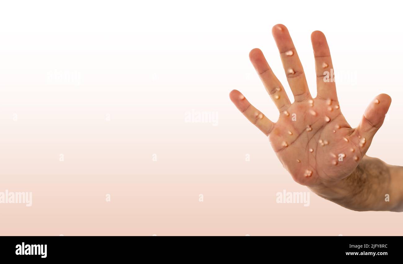 Poignée de main gantée Banque de photographies et d’images à haute ...