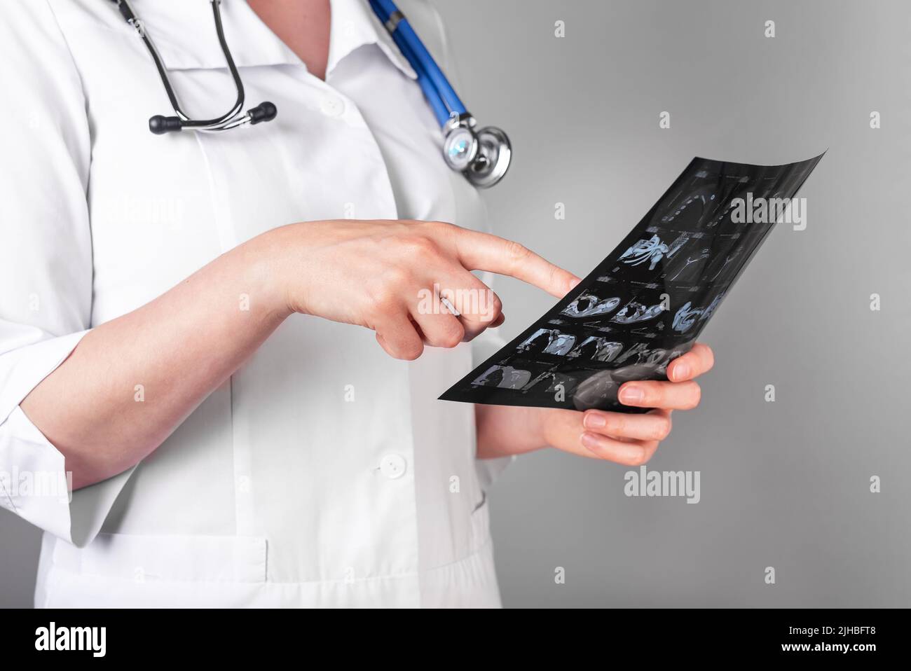 Médecin étudiant les résultats d'une acquisition CT ou IRM. Réalisation ...