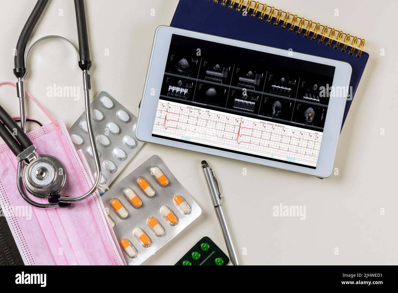 Il s'agit d'une capture d'écran de la vue d'un échocardiogramme ...