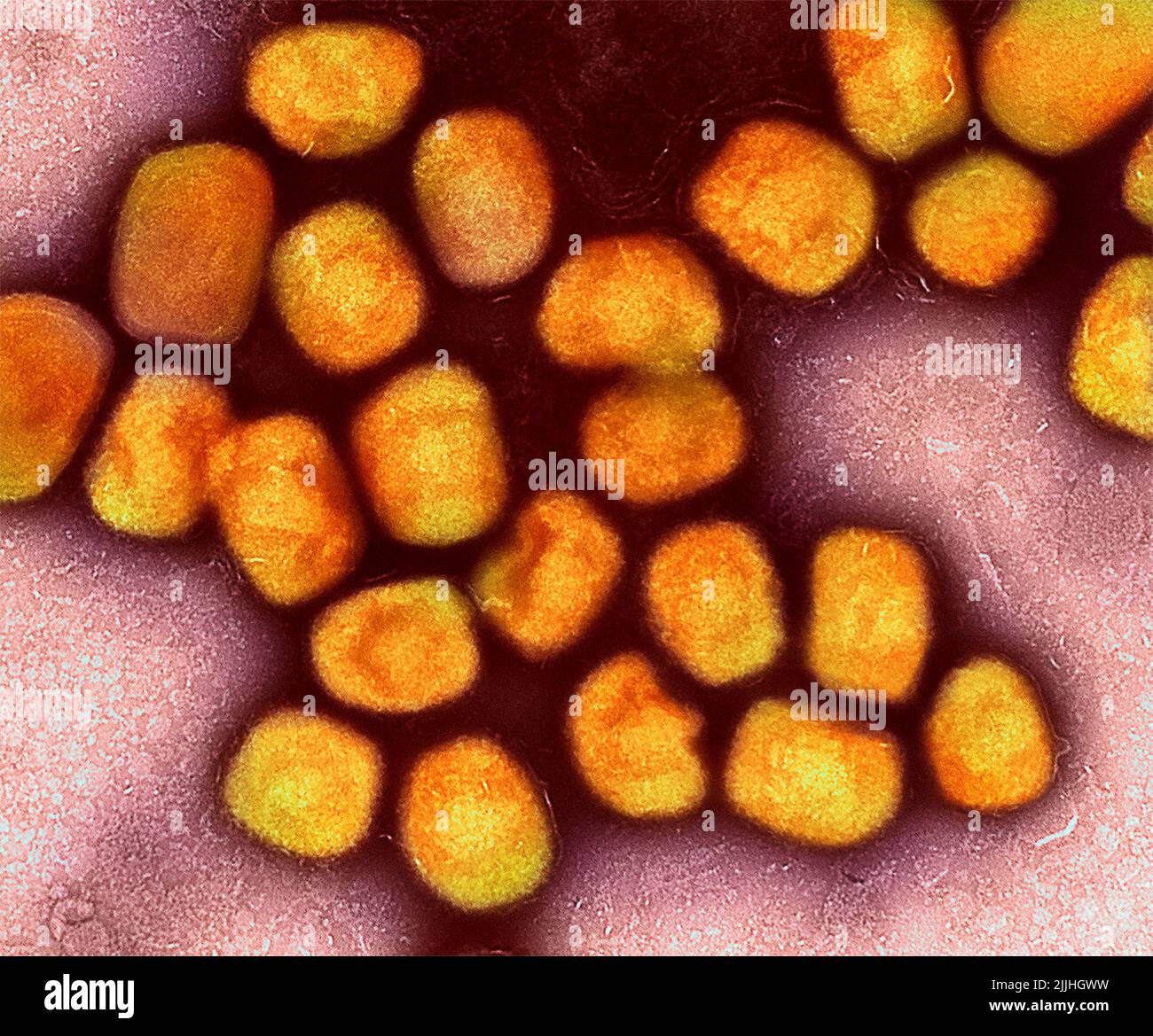 Varicella zoster micrograph Banque de photographies et d’images à haute ...