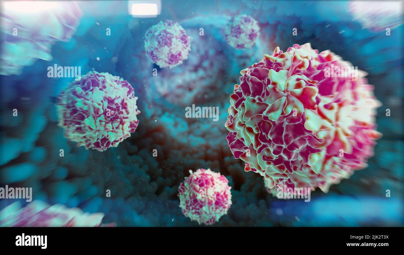 Polio disease Banque de photographies et d’images à haute résolution ...