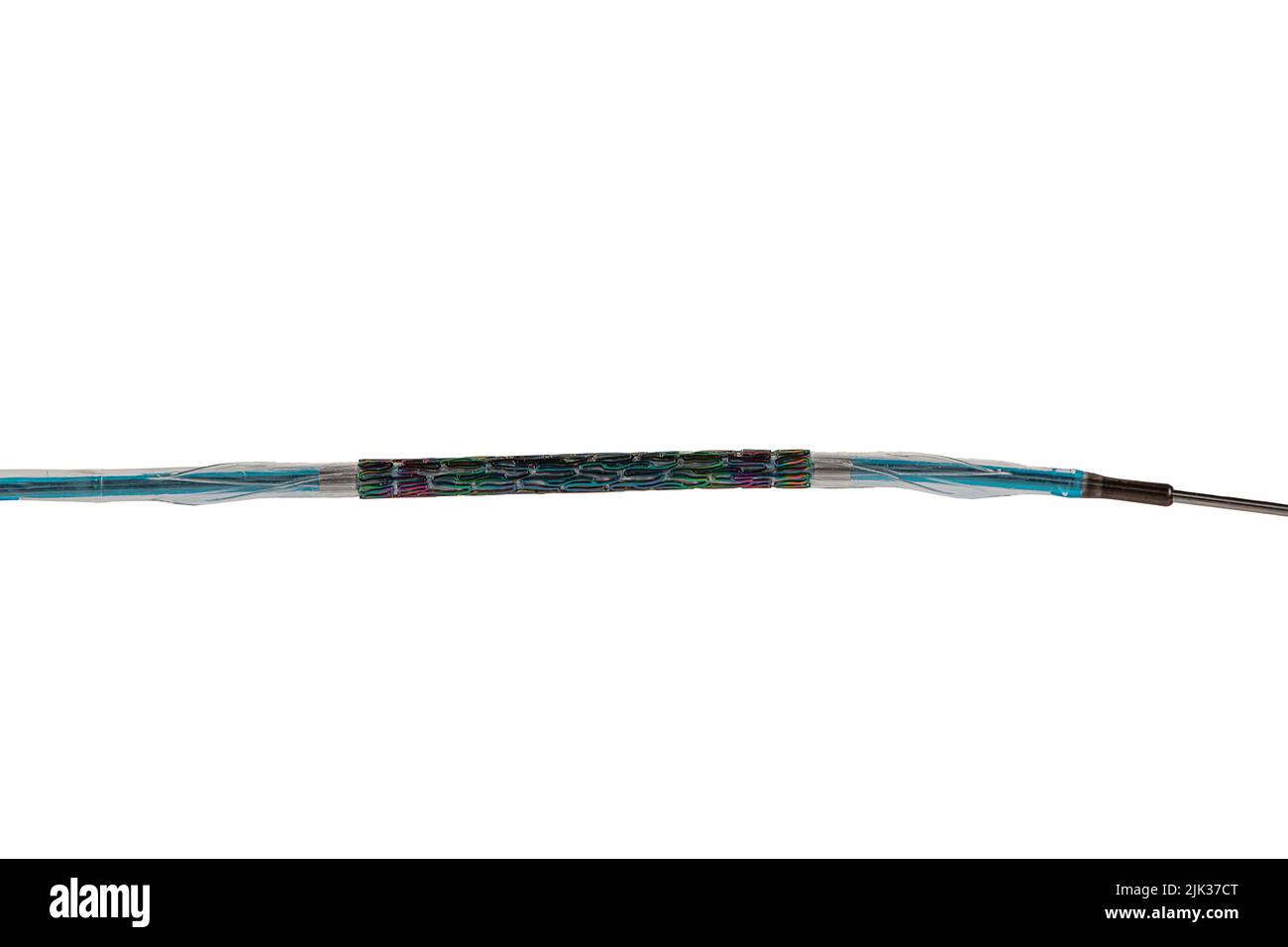 Angioplastie du stent cardiaque. Stent et cathéter à implanter dans les ...