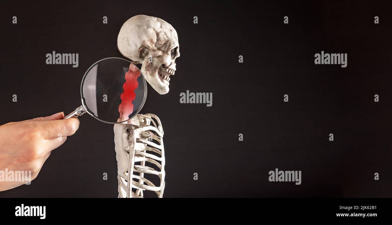 Anatomie du cou humain Banque de photographies et d’images à haute ...