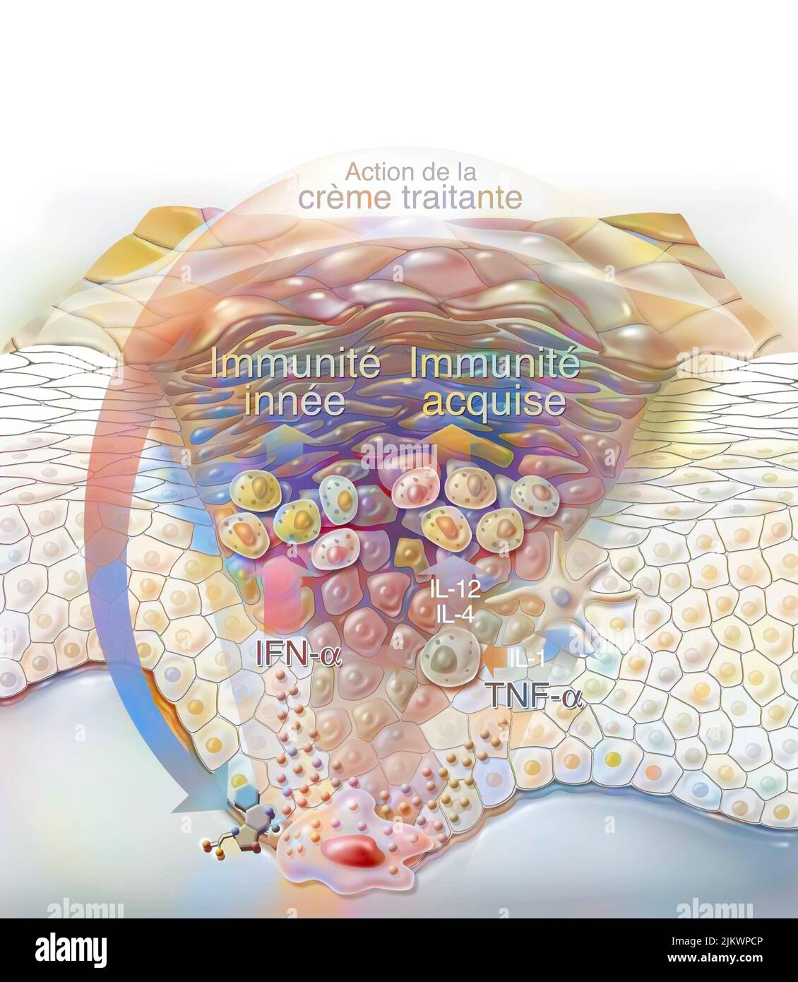 Nécrose cutanée Banque de photographies et d’images à haute résolution ...