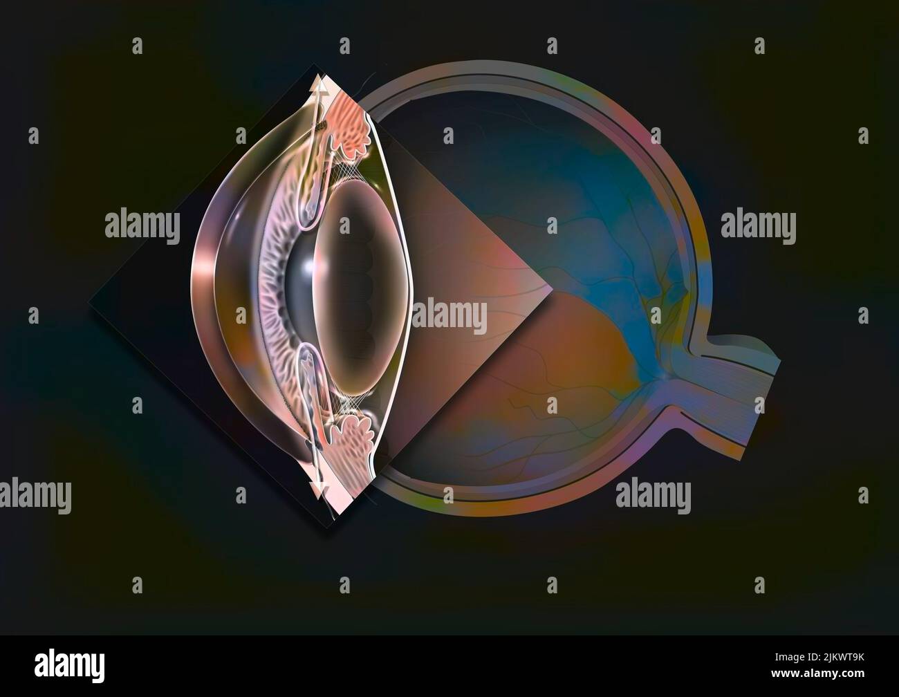 Pathologie oculaire Banque de photographies et d’images à haute ...