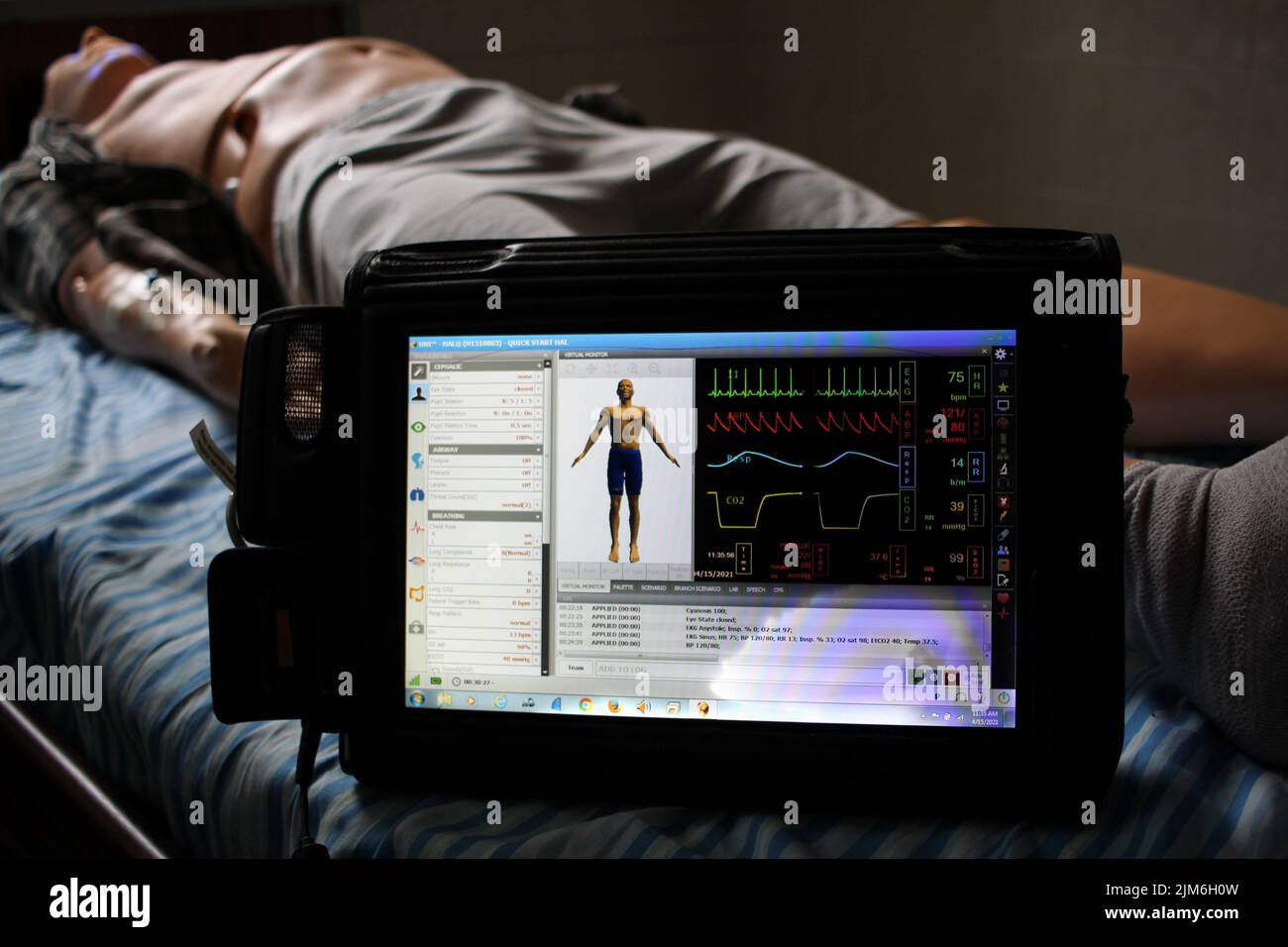 Simulateur de patient et moniteur de correction des données vus à l ...