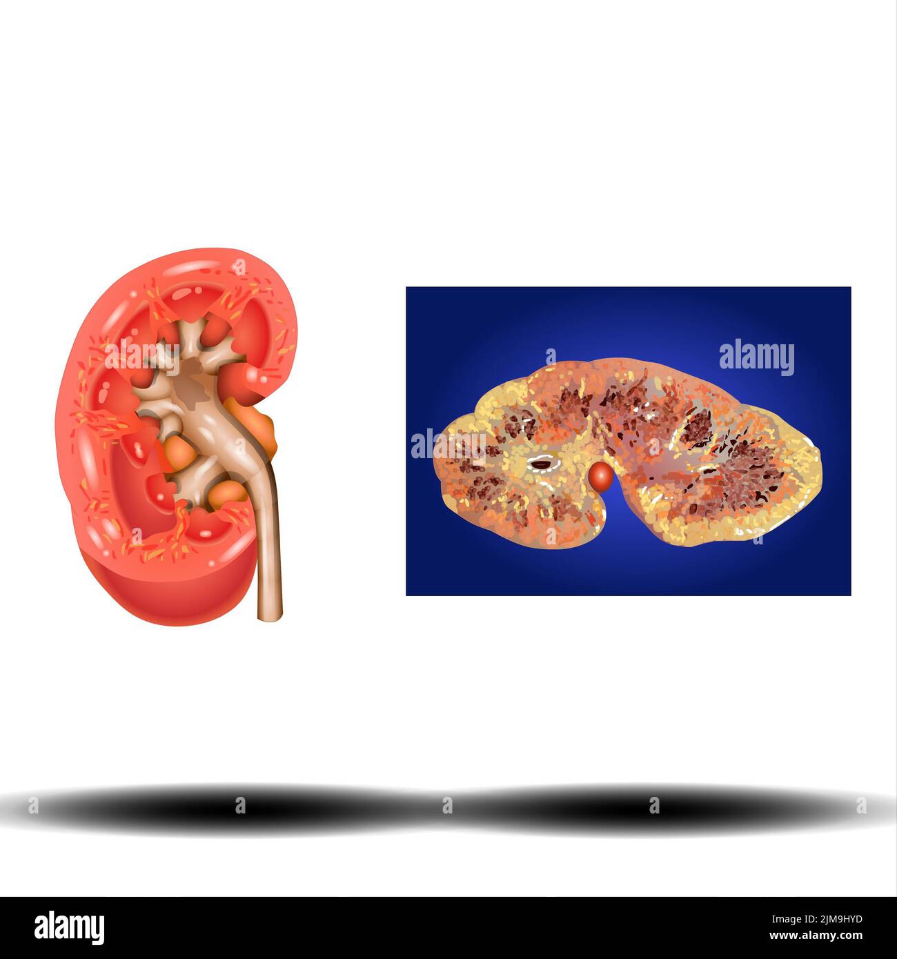 Biología de la anatomía del órgano arteria renal Banque de ...