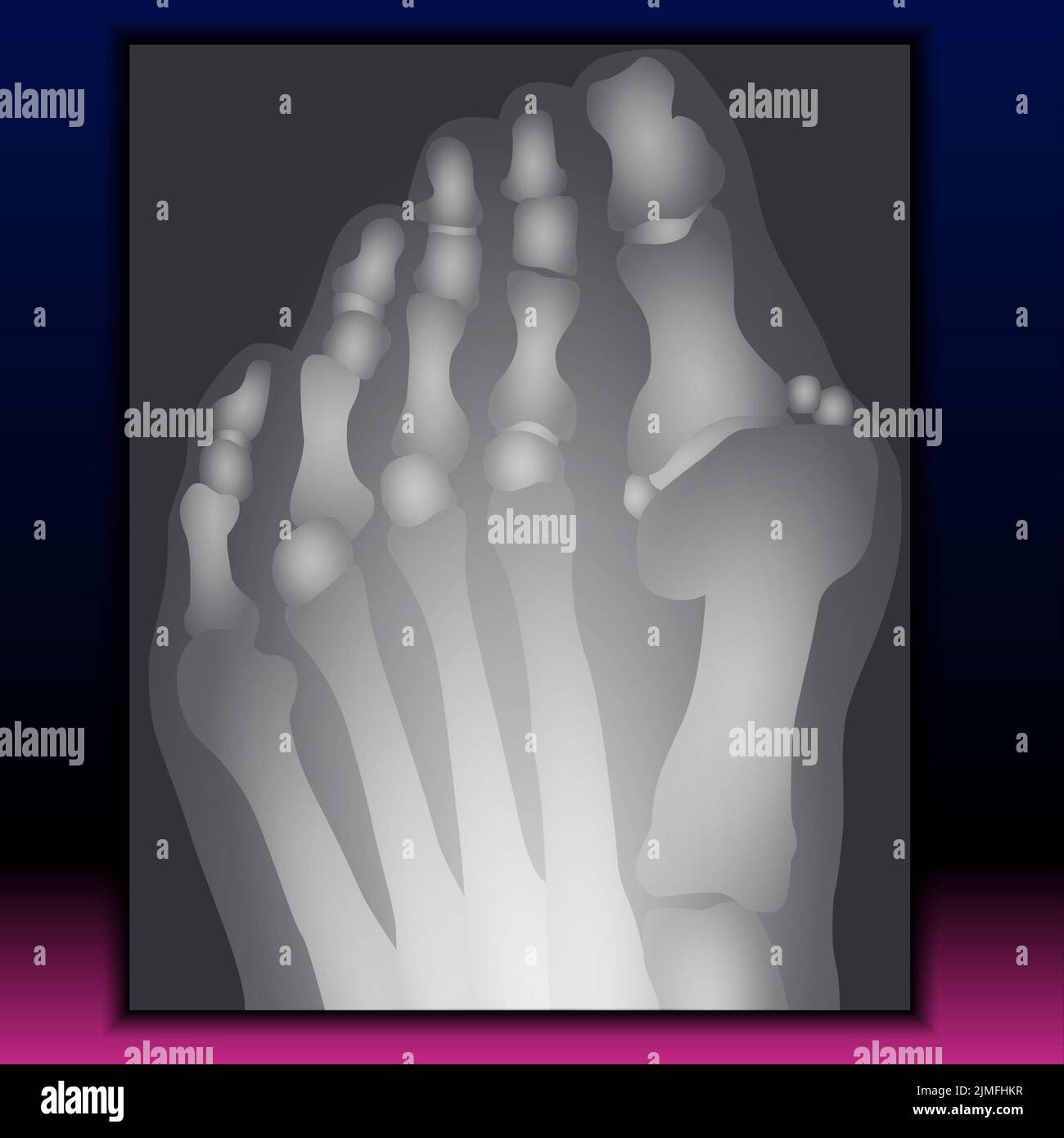 Radiologie pied Banque de photographies et d’images à haute résolution ...