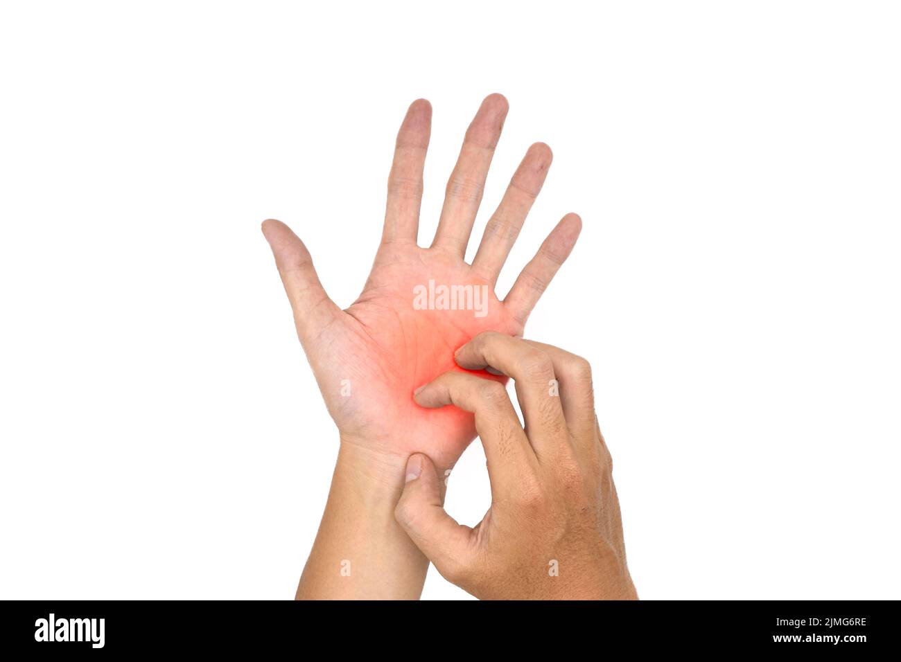 Maladie de peau avant bras Banque d'images détourées - Alamy