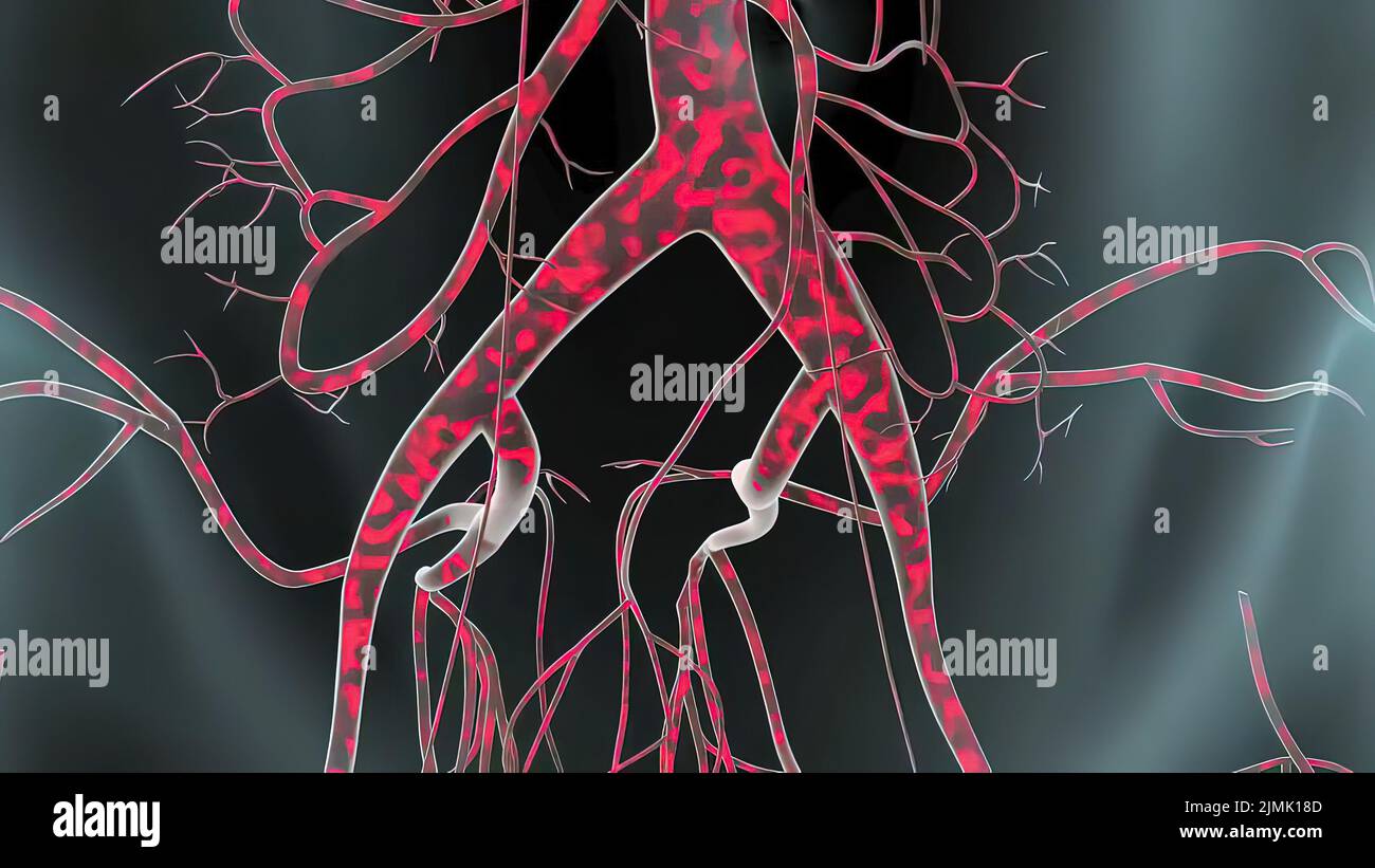 Abdominal aorta Banque de photographies et d’images à haute résolution ...