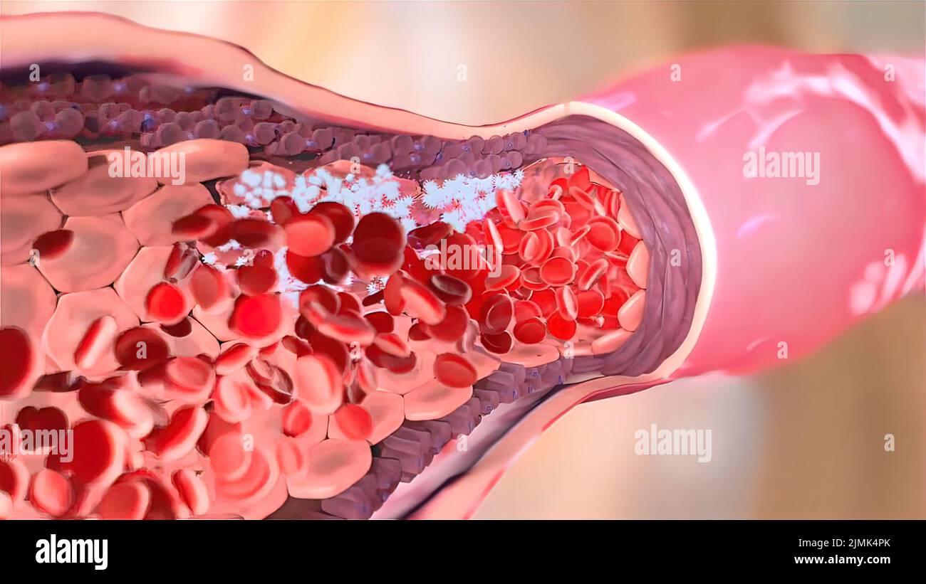 Processus de coagulation Banque de photographies et d’images à haute ...