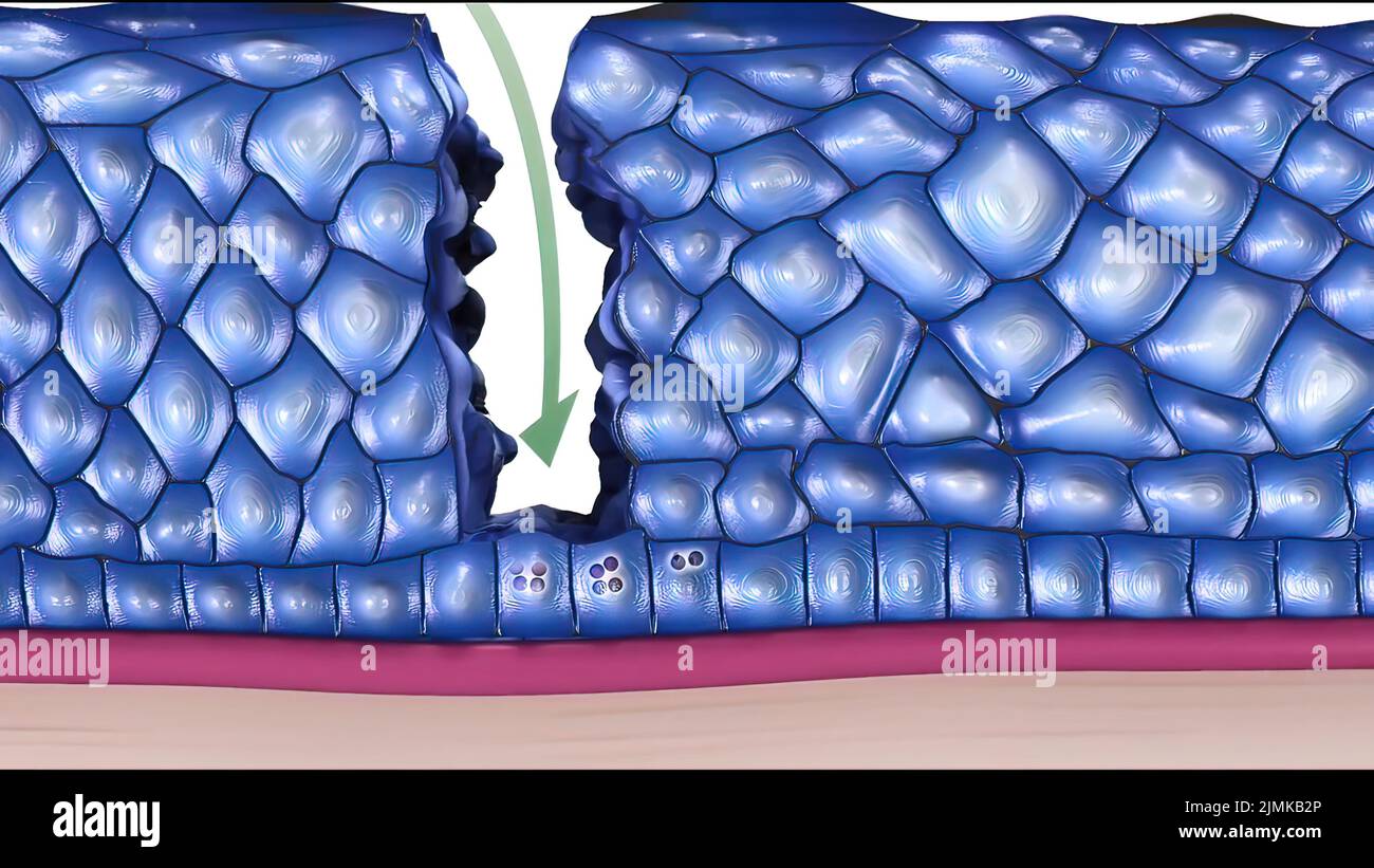 Virus du papillome humain féminin Banque de photographies et d’images à ...