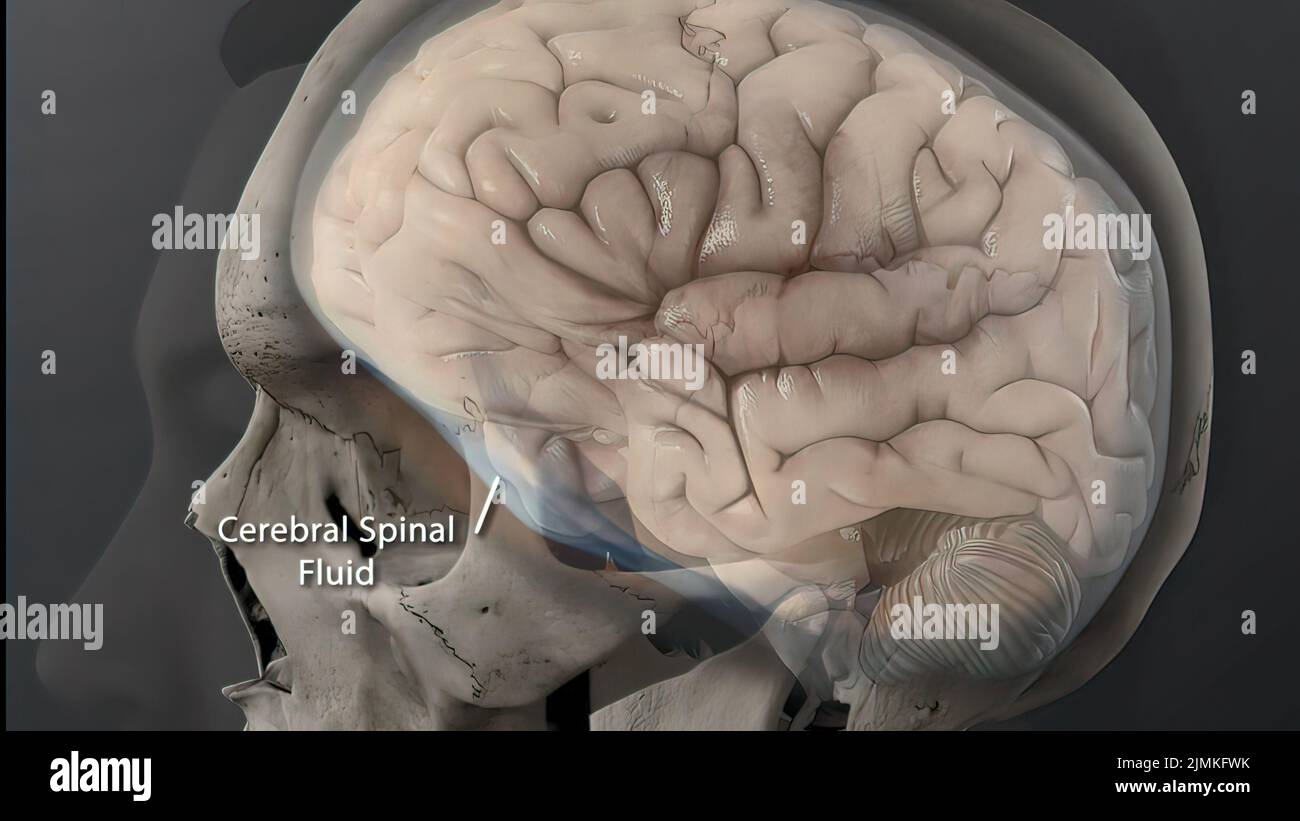 Liquide cephalo rachidien Banque de photographies et d’images à haute ...