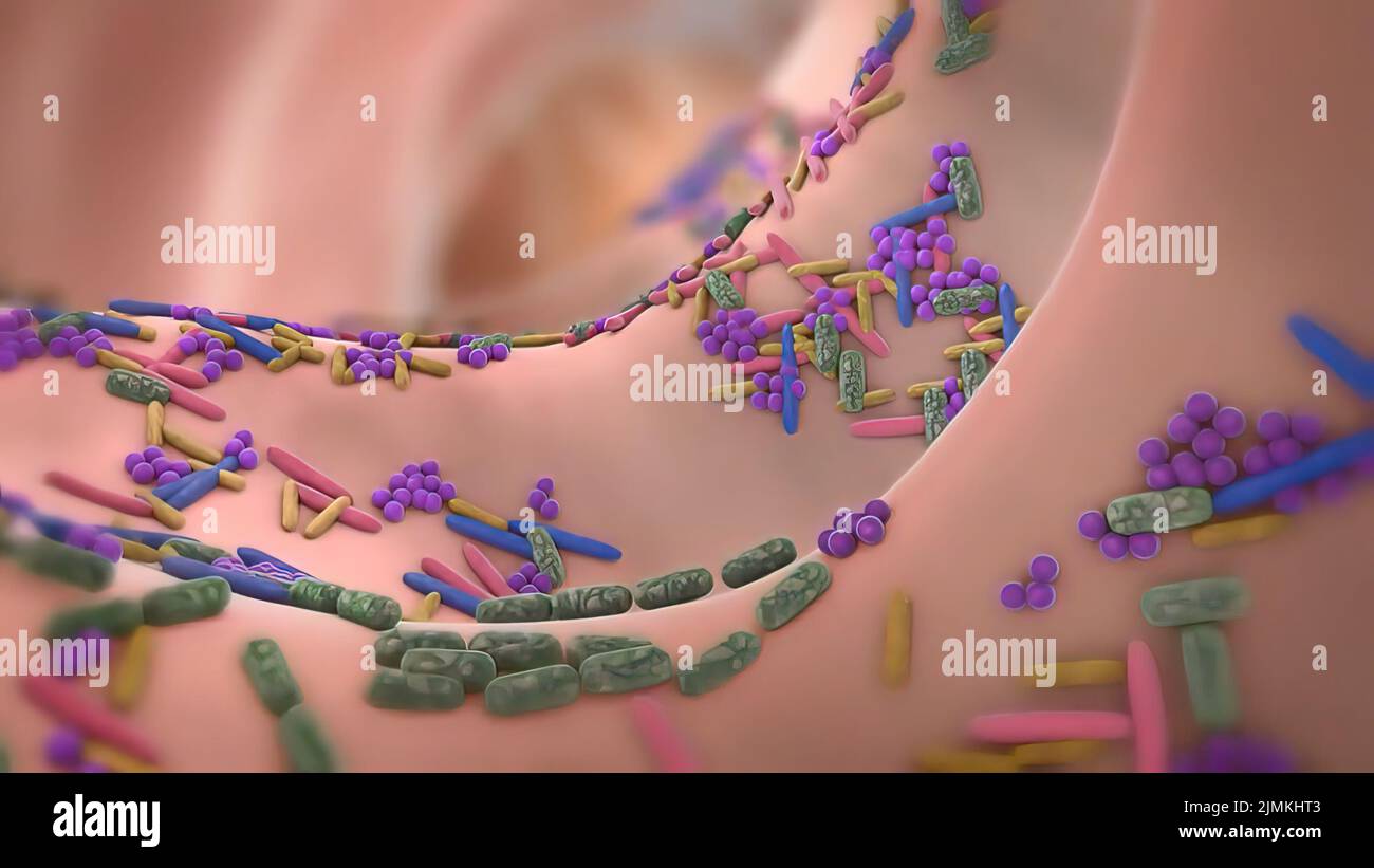 órganos infectados Banque de photographies et d’images à haute ...