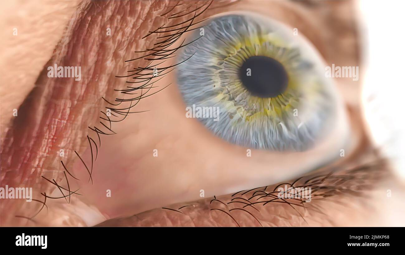 Inflammation oculaire Banque de photographies et d’images à haute ...