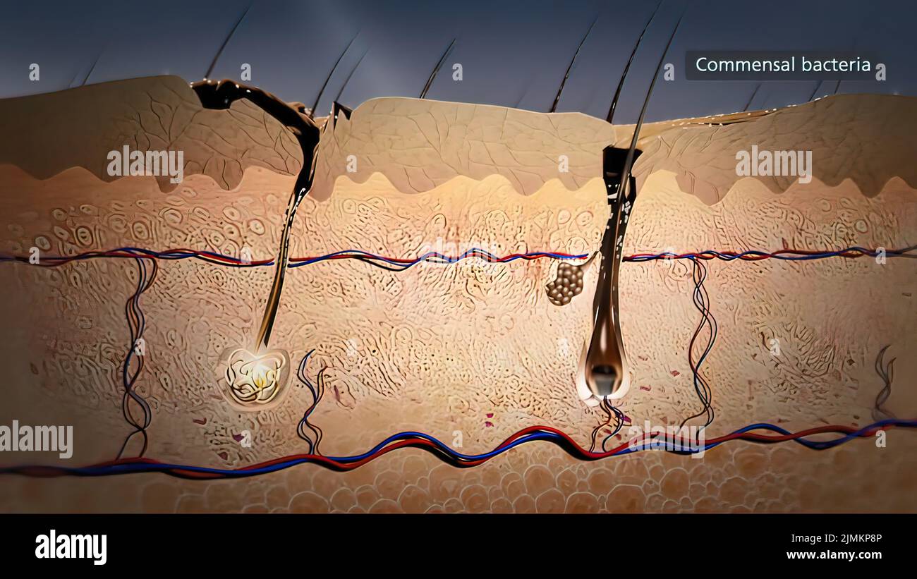 Swelling skin Banque de photographies et d’images à haute résolution ...