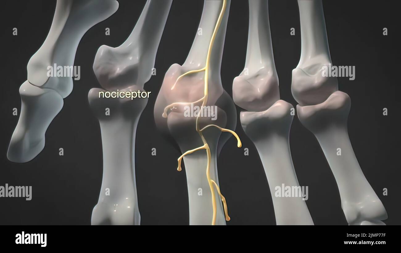 Doigts enflés Banque de photographies et d’images à haute résolution ...