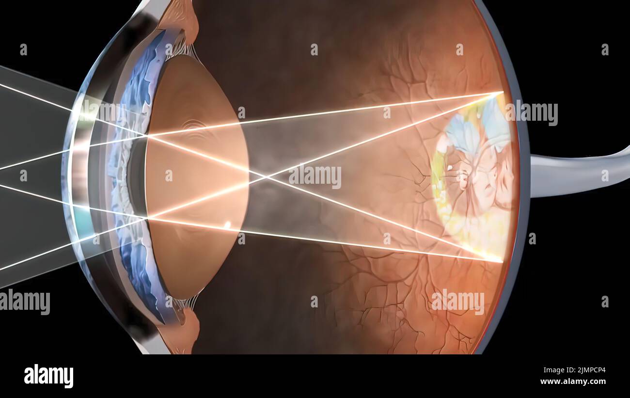 Processus ciliaire Banque de photographies et d’images à haute ...