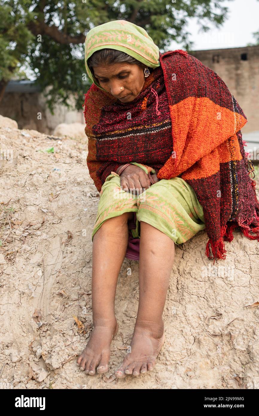 La filariose est une maladie infectieuse tropicale causée par un des ...