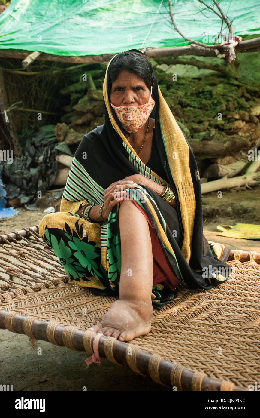 La filariose est une maladie infectieuse tropicale causée par un des ...