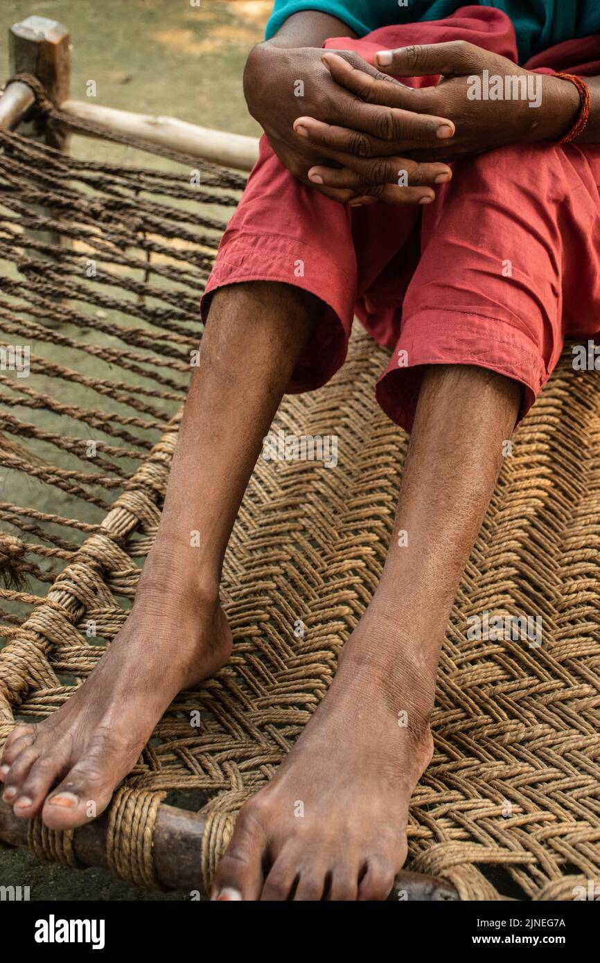 La filariose est une maladie infectieuse tropicale causée par un des ...