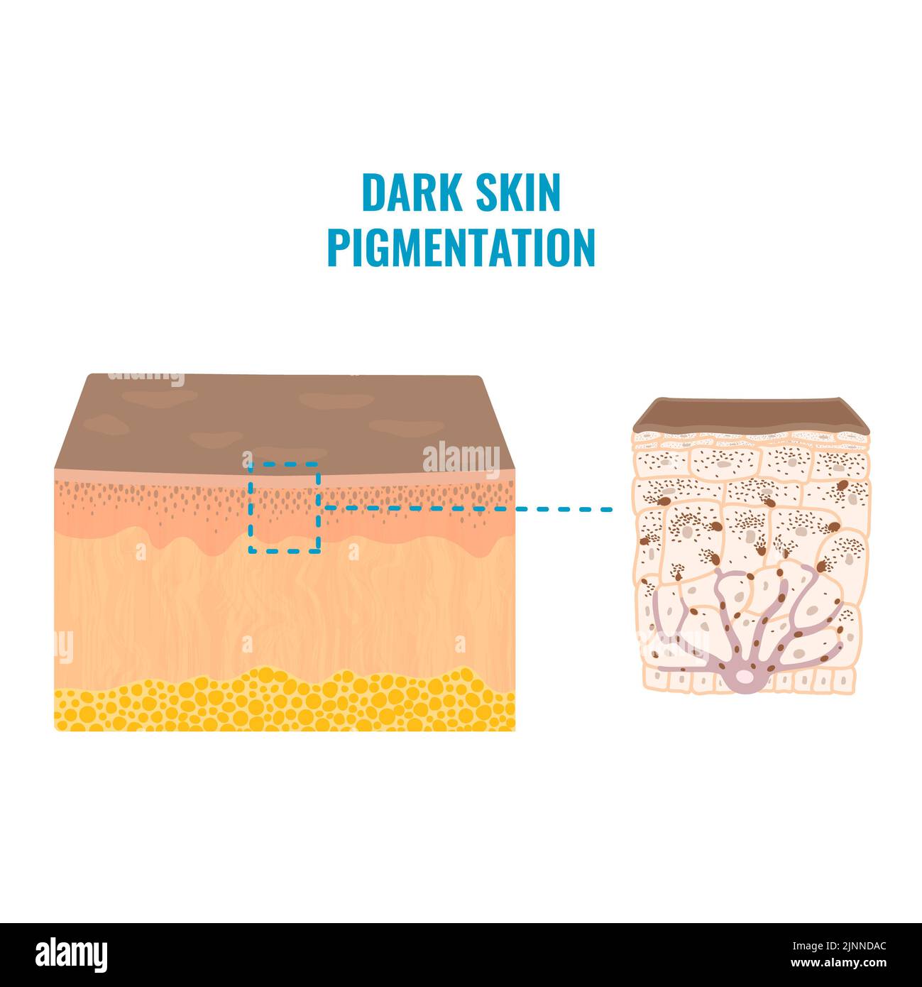 Pigmentation de la peau Banque de photographies et d’images à haute ...